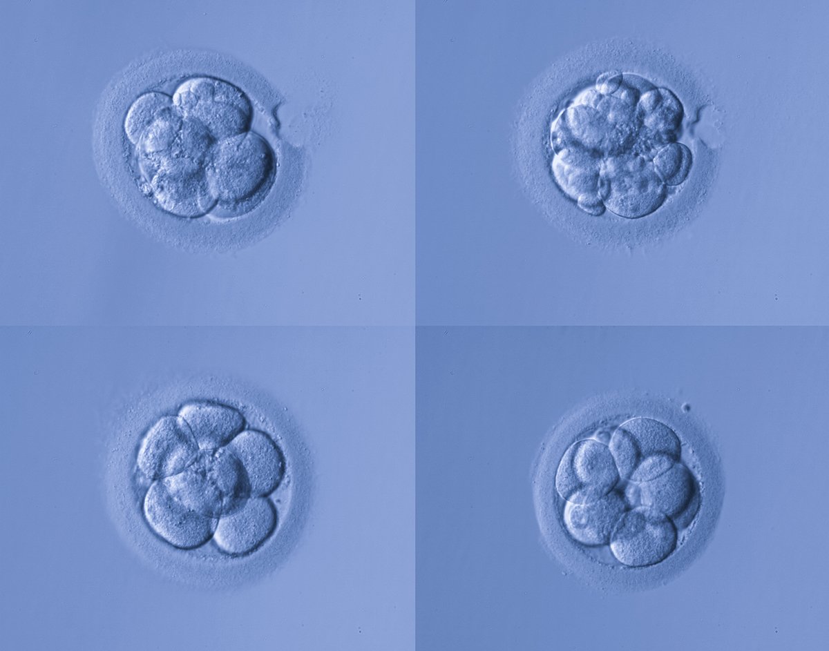 Chromosomal Abnormalities