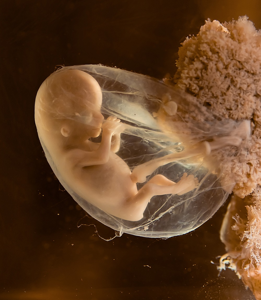 Reproduktionsimmunologie: Was ist das, ihre Ursachen, ihre Behandlung ...