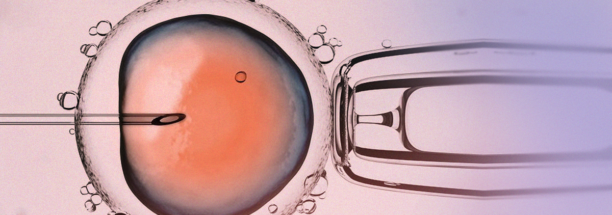 Intracytoplasmic Sperm Injection (icsi)