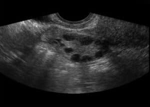 Die Follikel: Beschreibung, Anzahl, Wachstum und weitere Eigenschaften